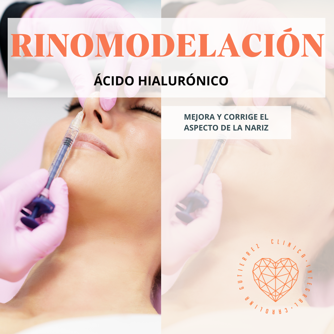 Rinomodelación - Acido Hialuronico – Clinica Carolina Gutierrez