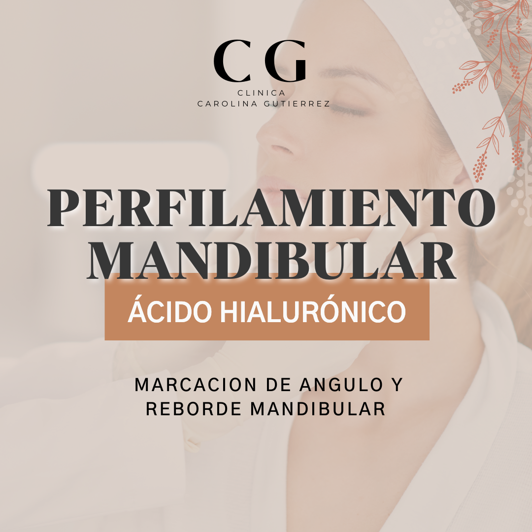 Perfilamiento Mandibular - Acido Hialurónico – Clinica Carolina Gutierrez